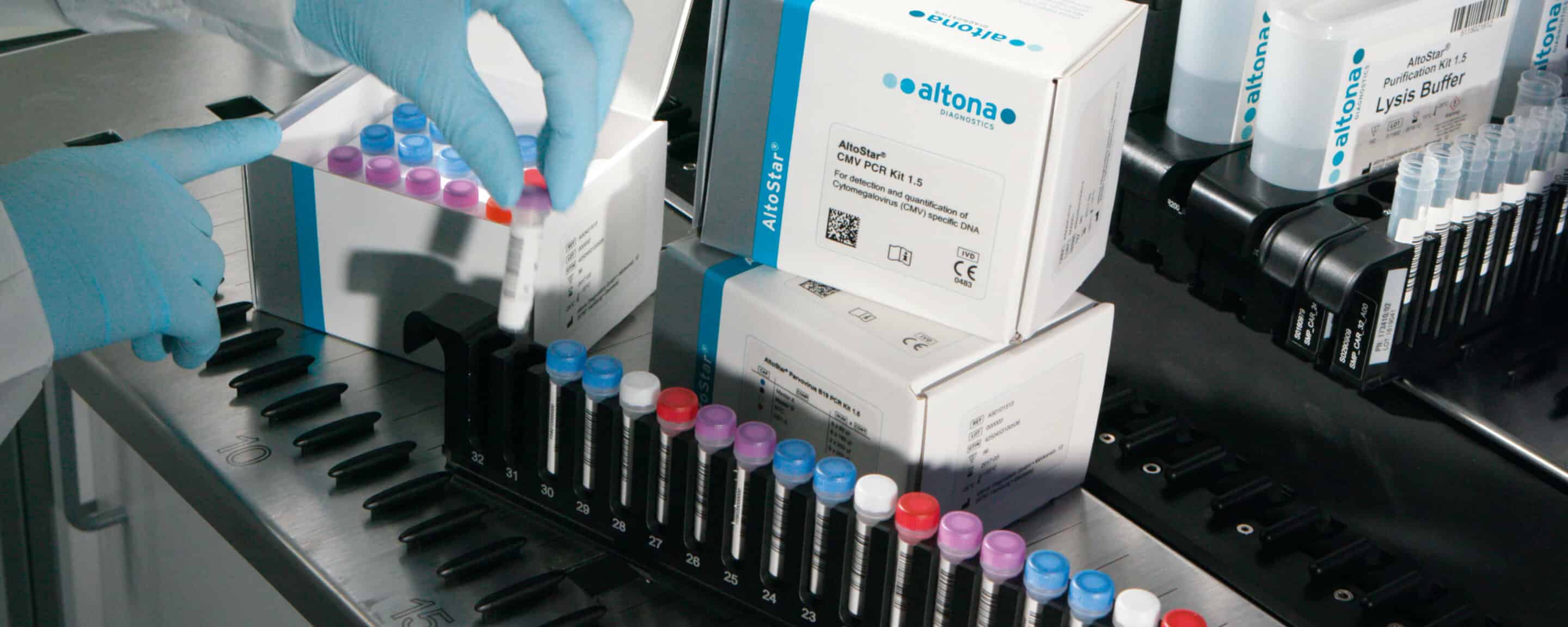 Altona Diagnostics | Clinomics Europe